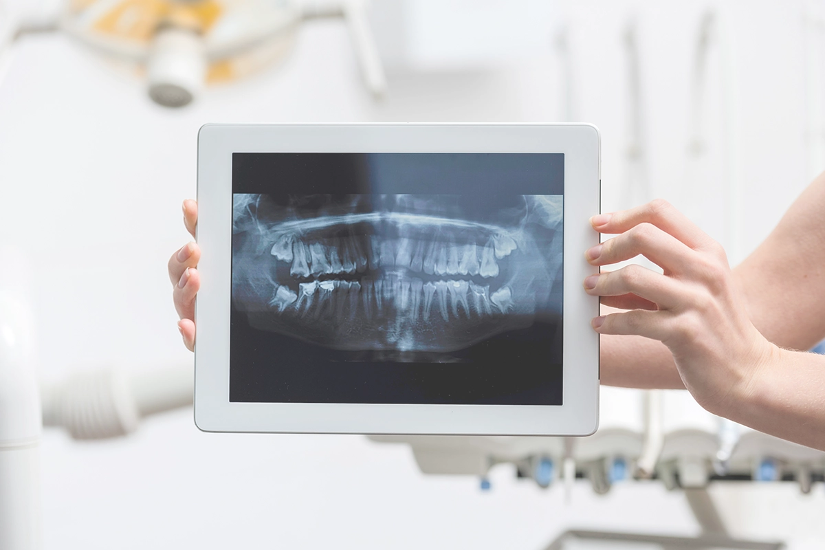 6. Digital X-Rays | Fabella Dental